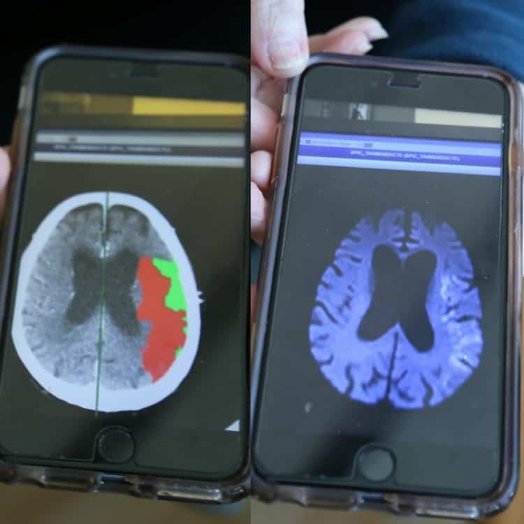 With Time on His Side, NLR Man Survives Stroke | UAMS News